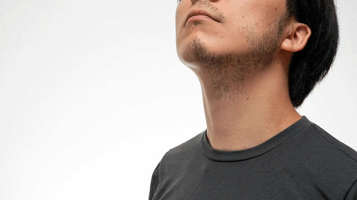 Beard Hair Transplant - All you need to know 2023
