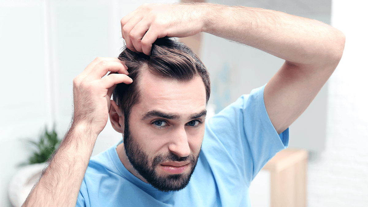 Receding Hairlines Hair Transplant - All you need to know 2023